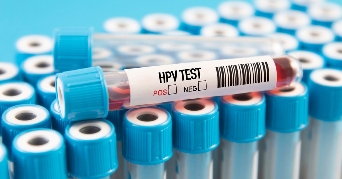 Decoding the hpv dna test. Your key to cervical cancer prevention.